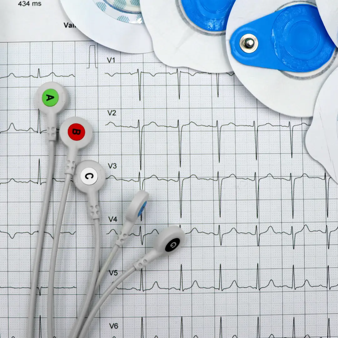 Everything You Should Know About Electrocardiography (ECG) - Asian ...